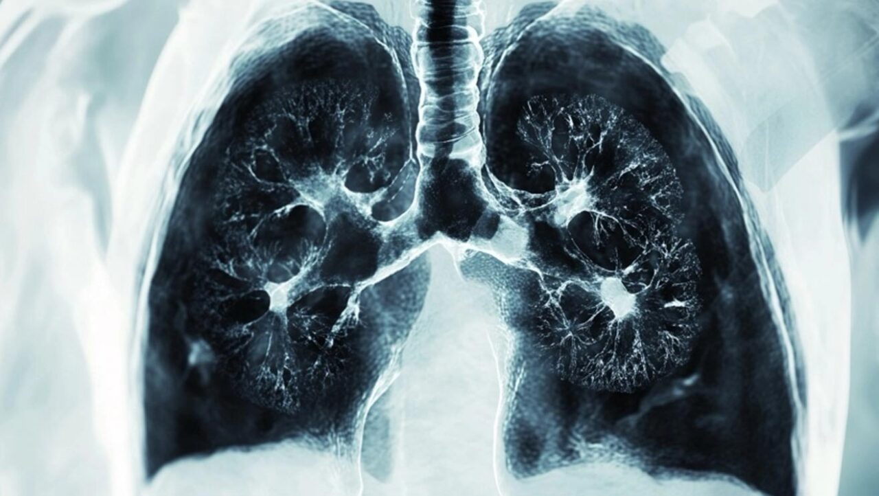 Asbestos Exposure 7 Steps to Take After Potential Risk